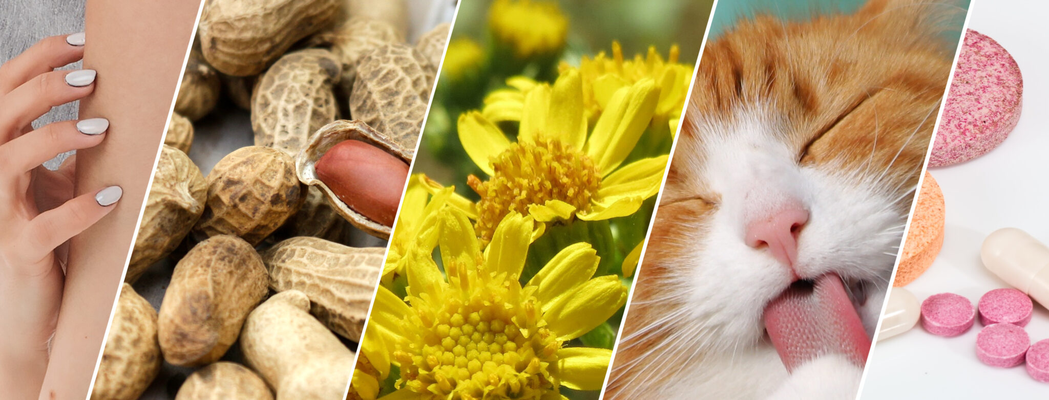 Allergic Diseases - Division of Allergy and Immunology
